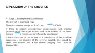 The Goslon Yardstick: Assessing Dental Arch Relationships in Children ...