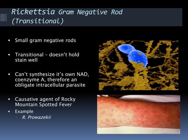 Gram negative bacteria.. | PPTX | Digestive Disorders | Diseases and ...