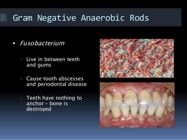 Gram negative bacteria..