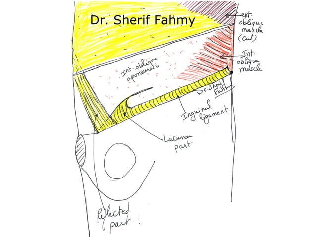 The Groin "Inguinal Region" (Anatomy of the Abdomen) | PPS | Death ...