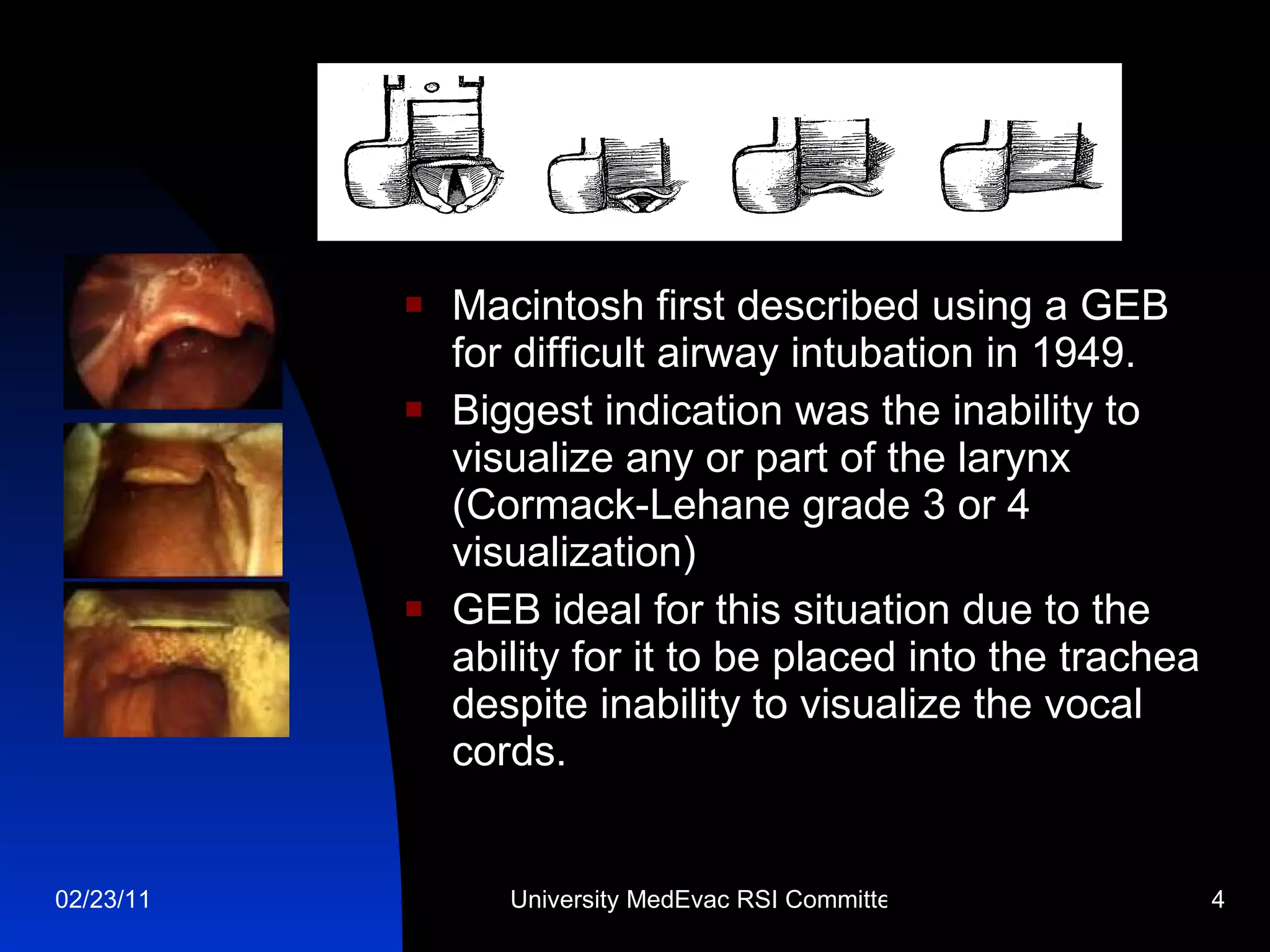 The Gum Elastic Bougie As An Alternative Ett2 | PPT | Air Travel ...