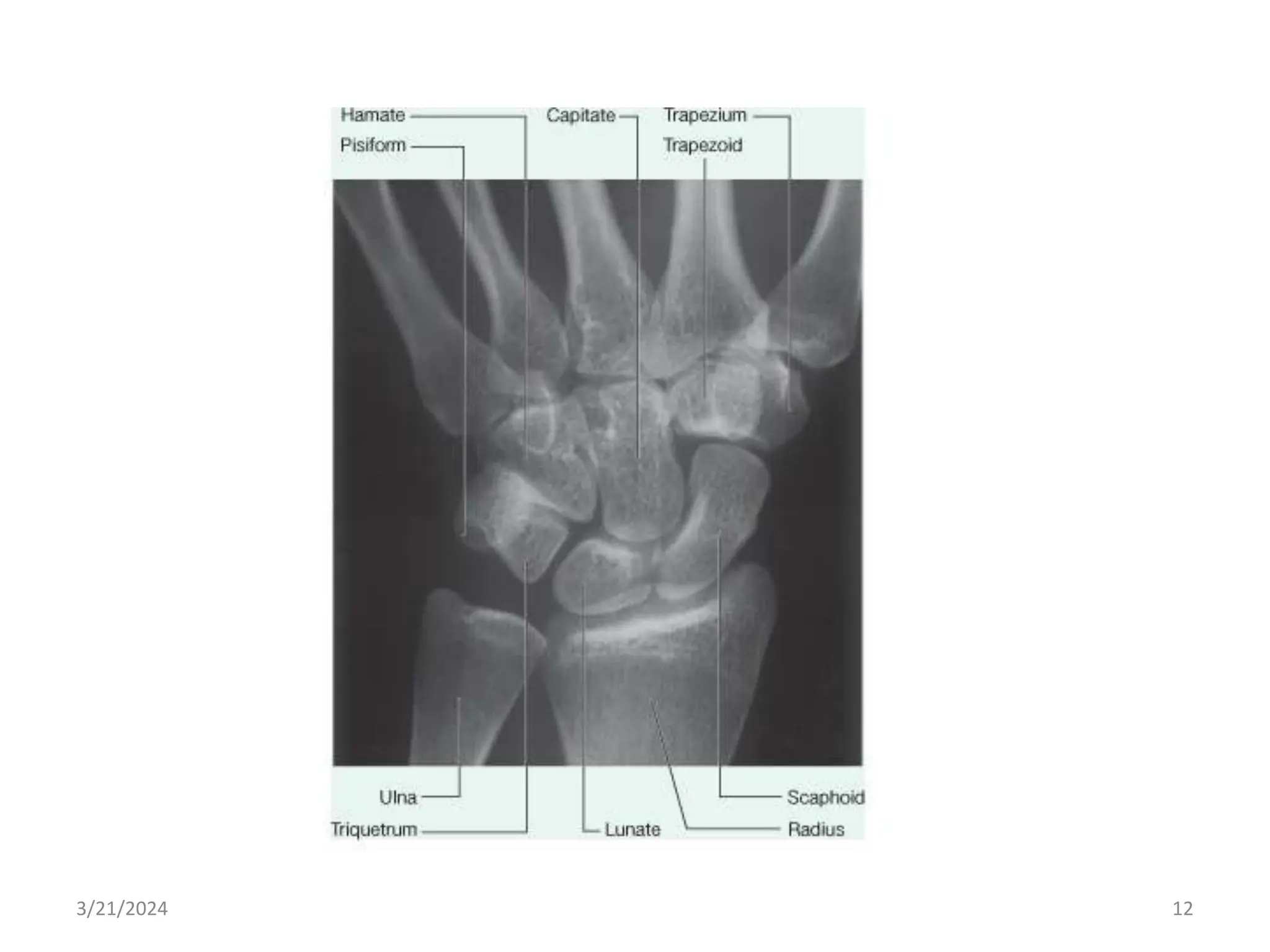 THE GROSS ANATOMY OF THE HAND PPPPTT.pptx