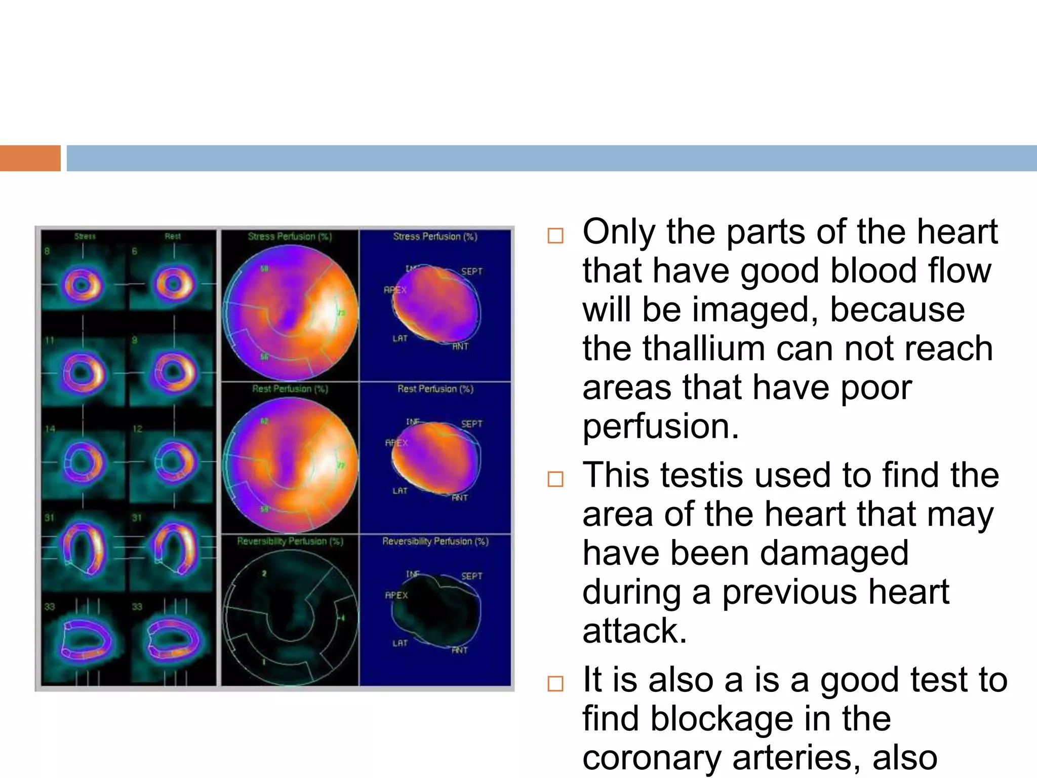 The heart and circulatory system | PPTX | Heart and Cardiovascular ...