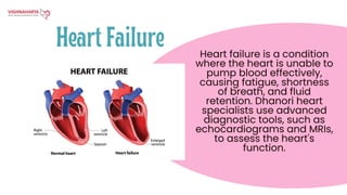 Cardiovascular Challenges: A Comprehensive Guide to Common Heart ...