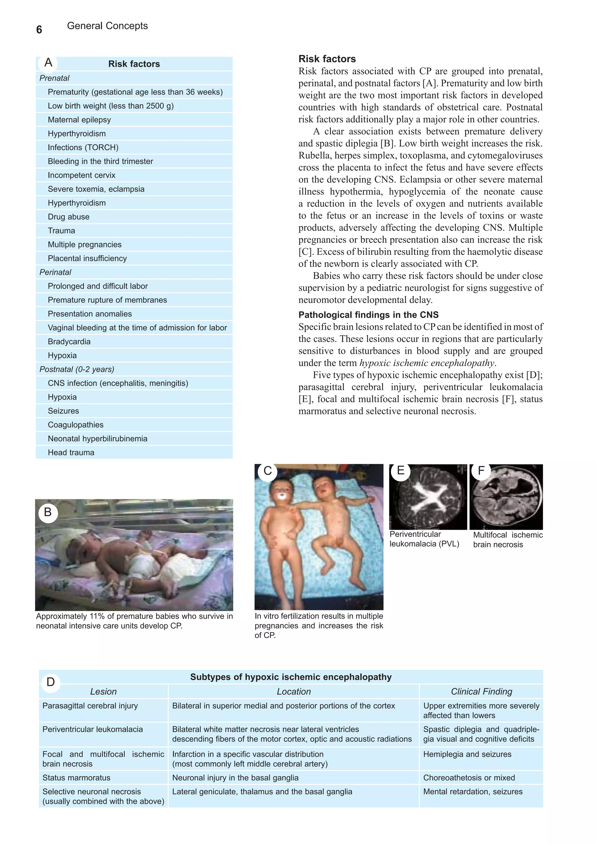 The help guide to cerebral palsy complete | PDF | Brain and Nervous ...