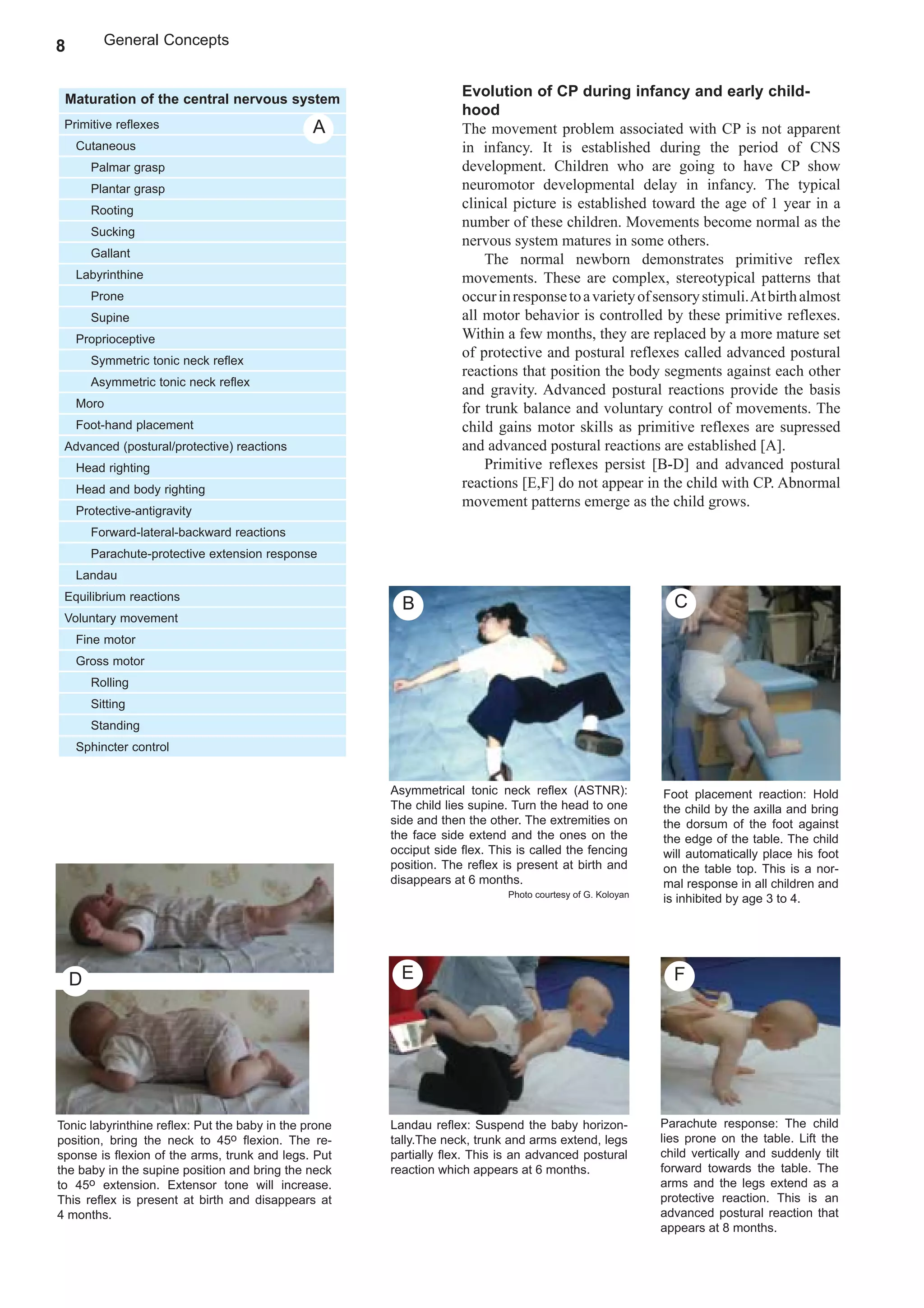 The help guide to cerebral palsy complete | PDF | Brain and Nervous ...