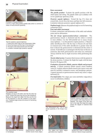 The help guide to cerebral palsy complete | PDF