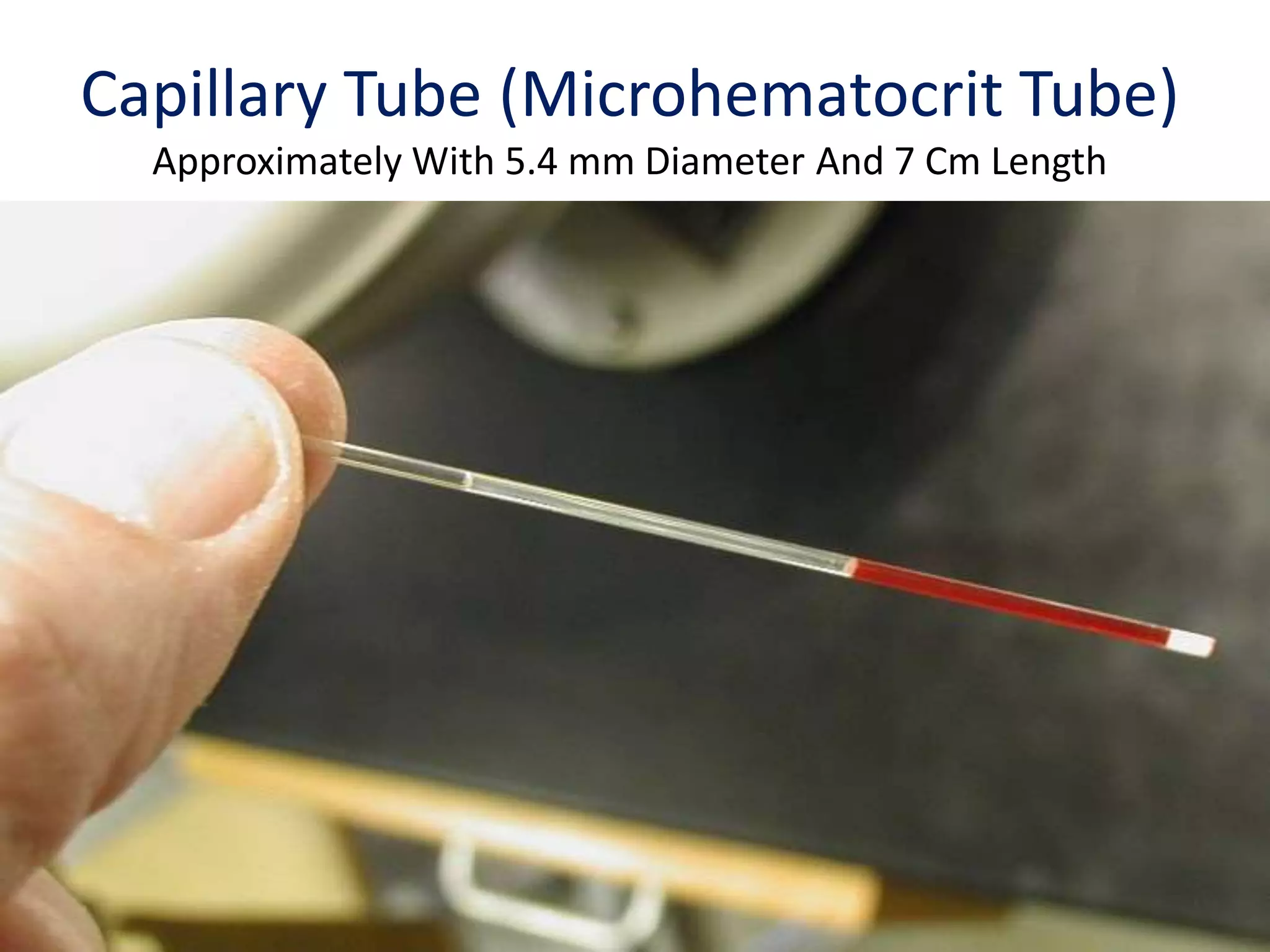 The hematocrit test | PPT