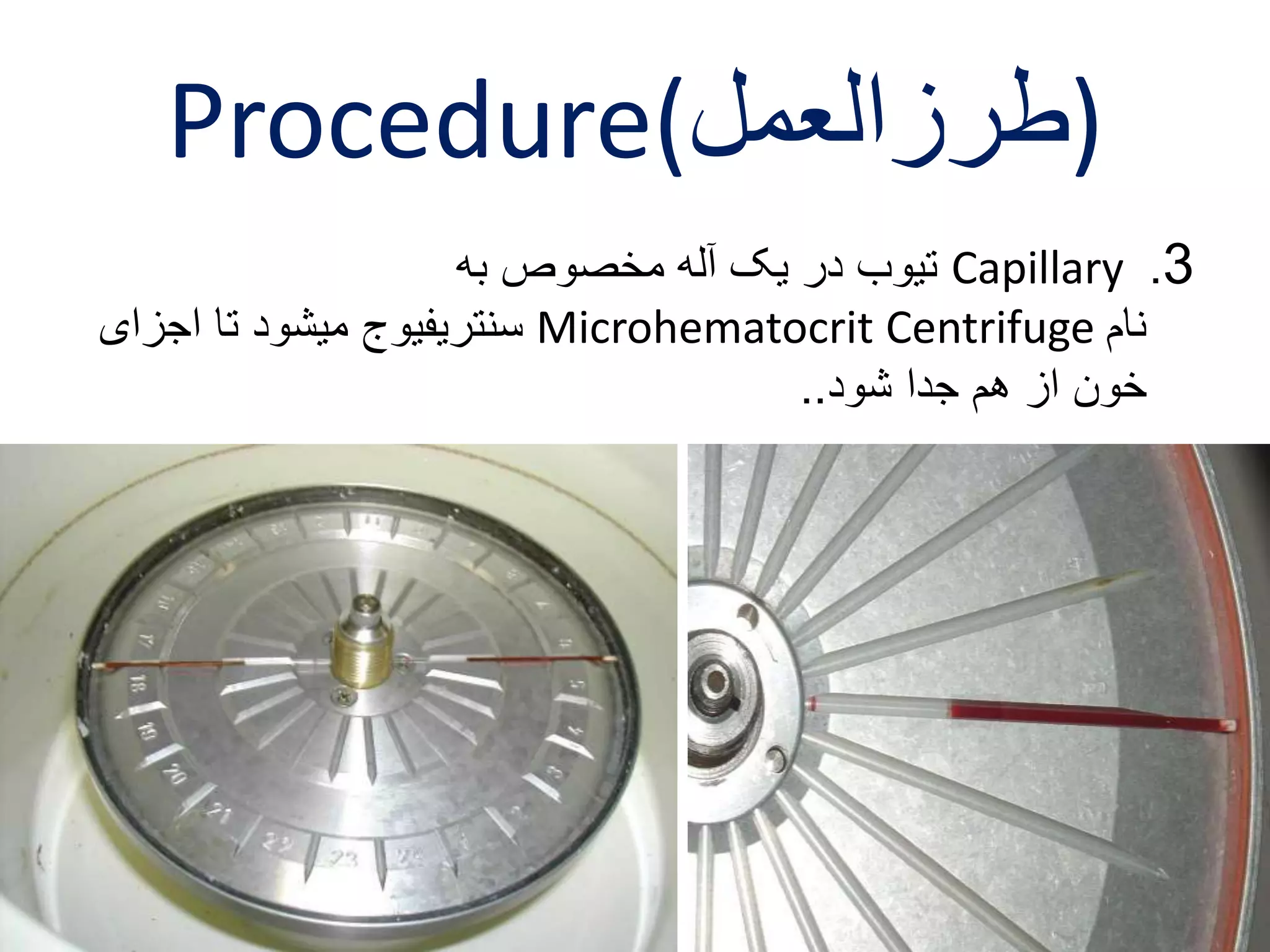 The hematocrit test | PPTX