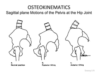 The Hip Biomechanics SRS | PPT