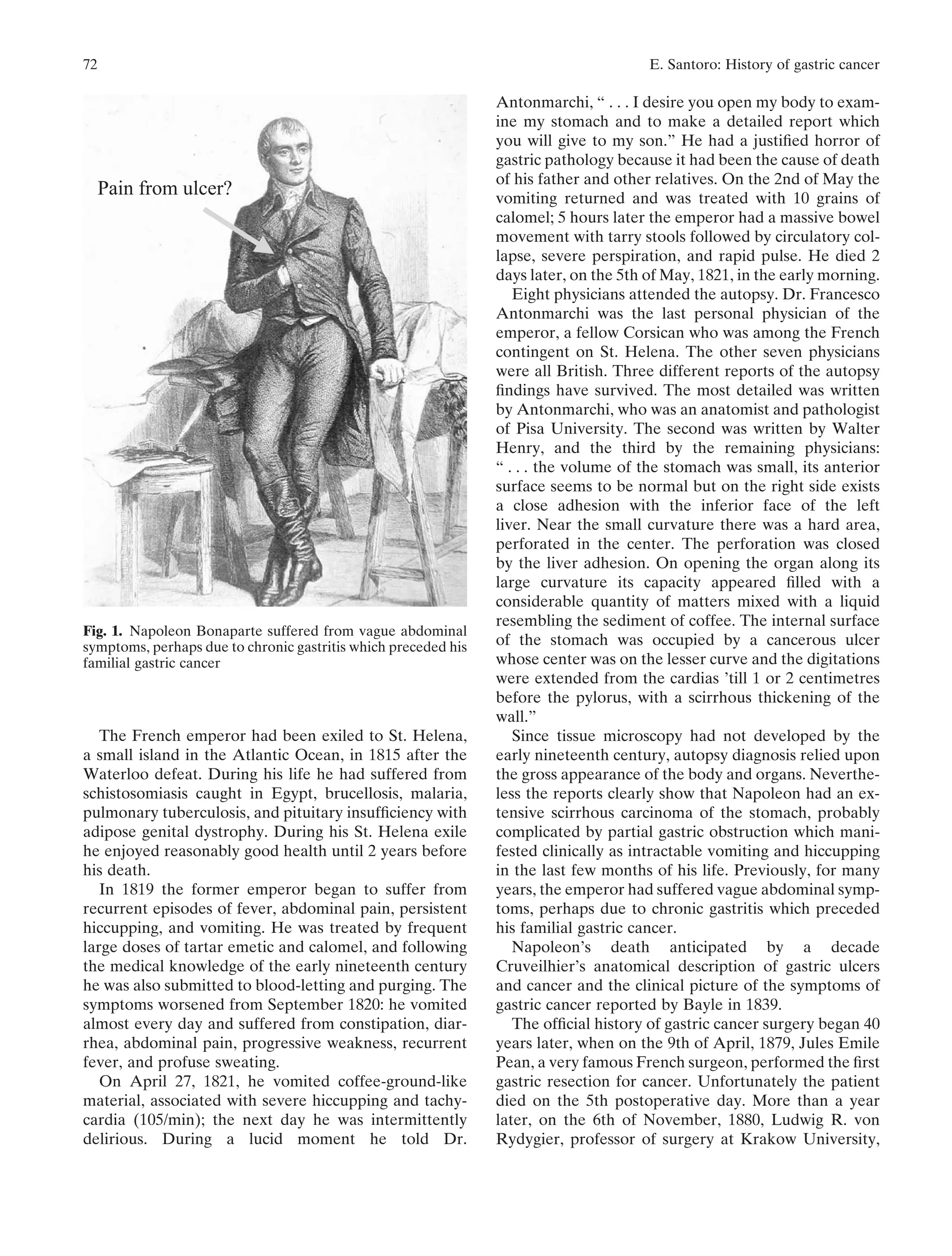 The history of gastric cancer | PDF