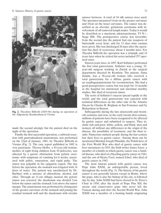 The history of gastric cancer | PDF