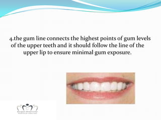 The hollywood smile | PPTX