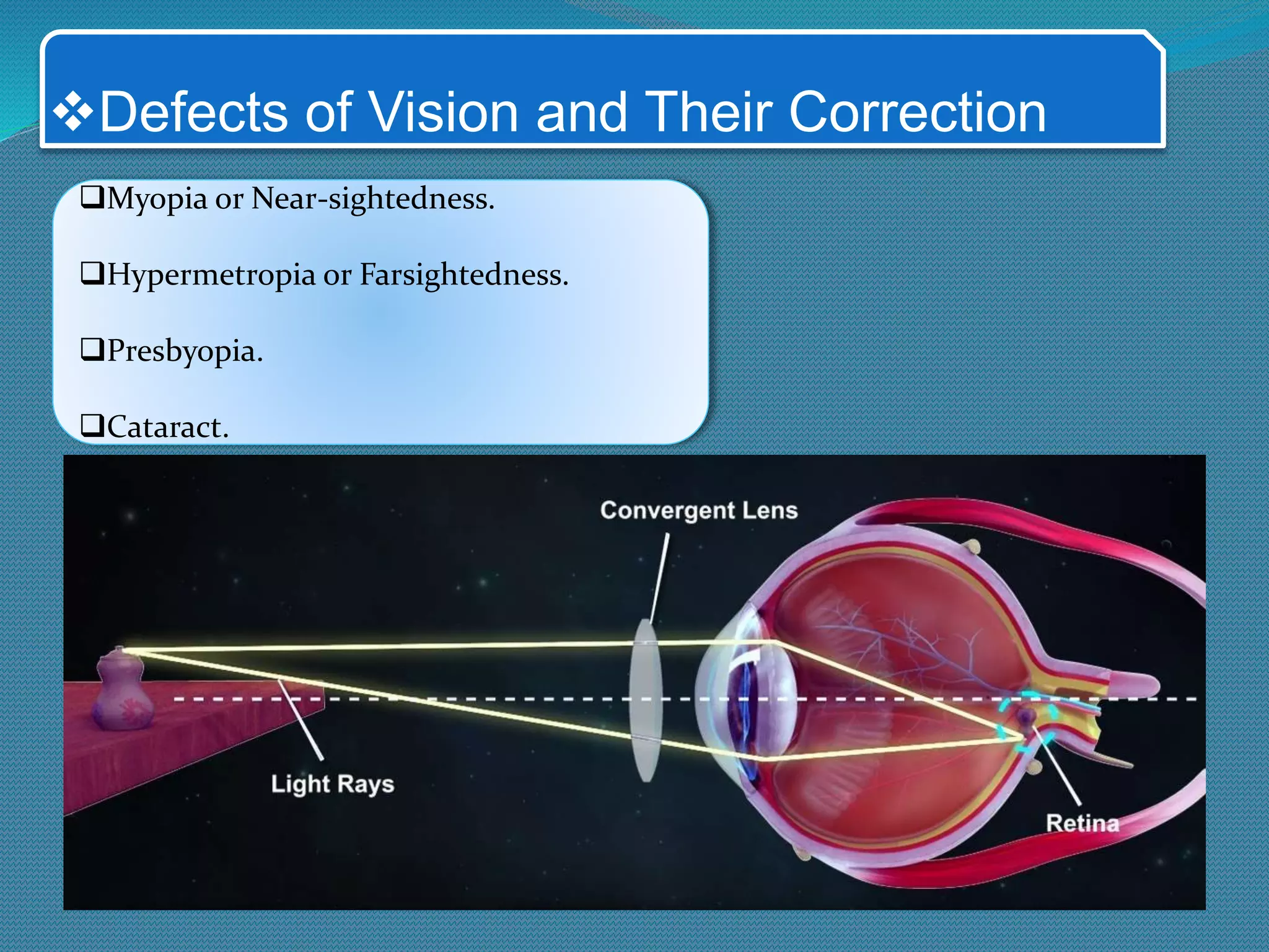 The human eye | PPT