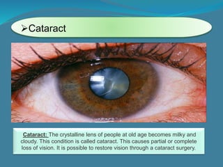 The human eye | PPTX