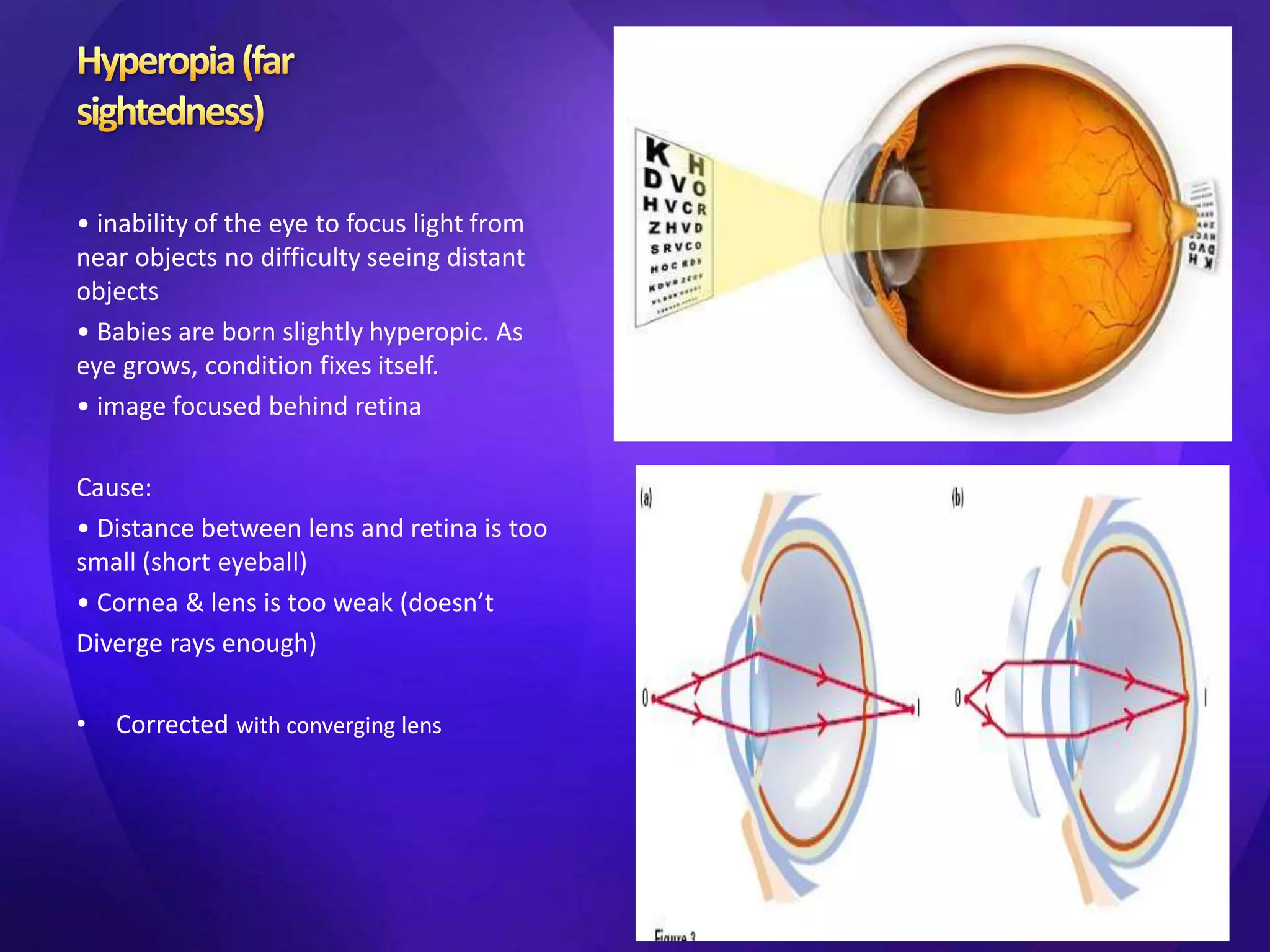 The human eye. group 1 | PPTX