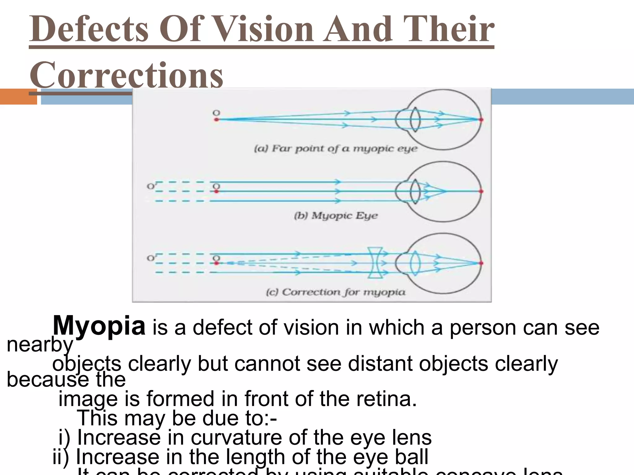 The human eye | PPTX