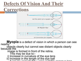 The human eye | PPTX