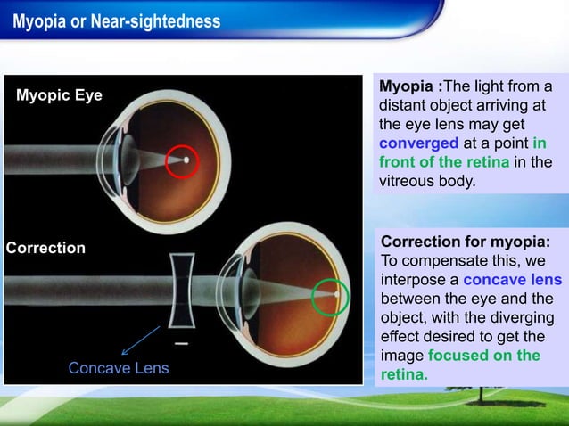 The human eye | PPTX