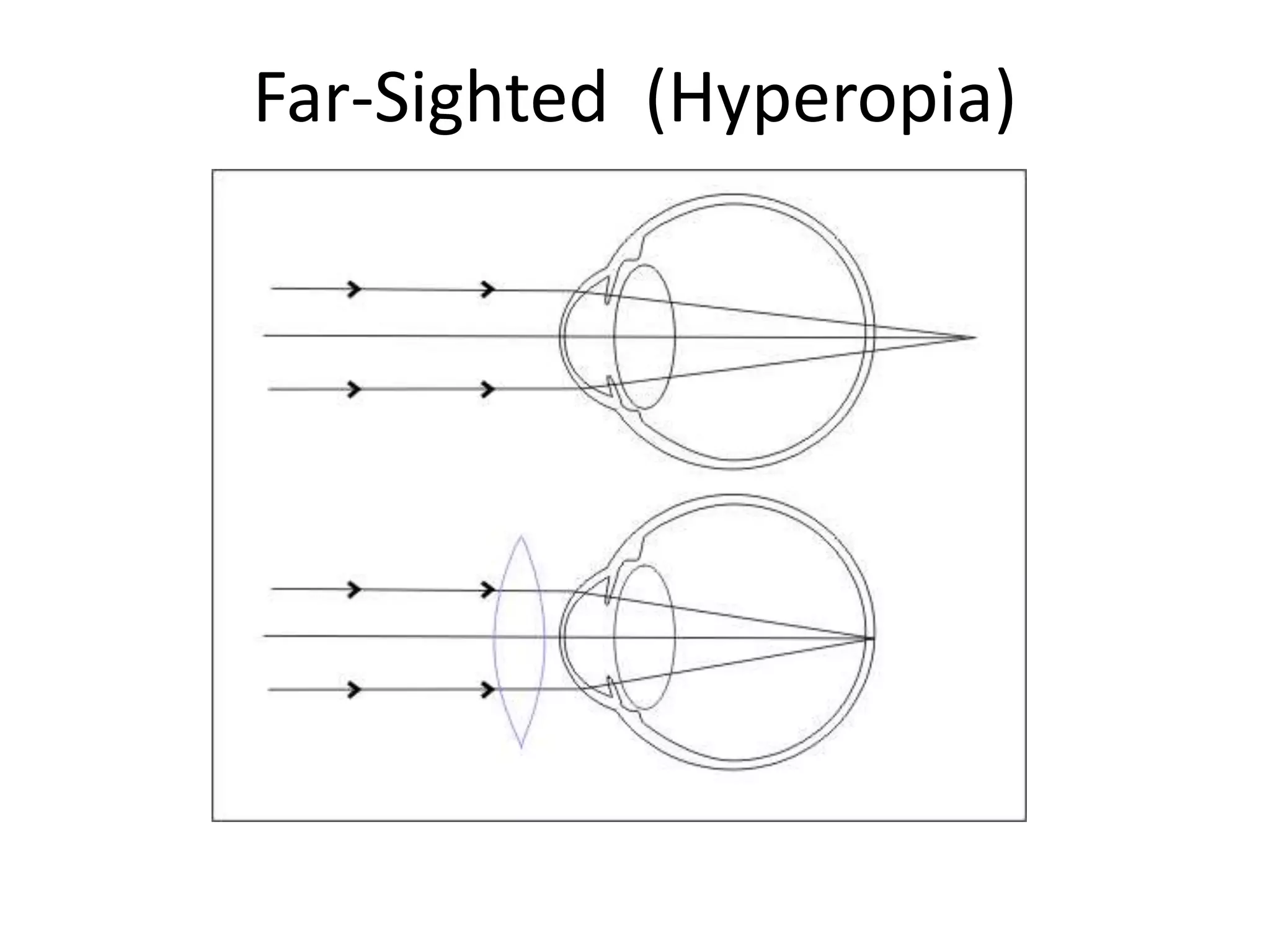 The Human Eye PowerPoint.pptx