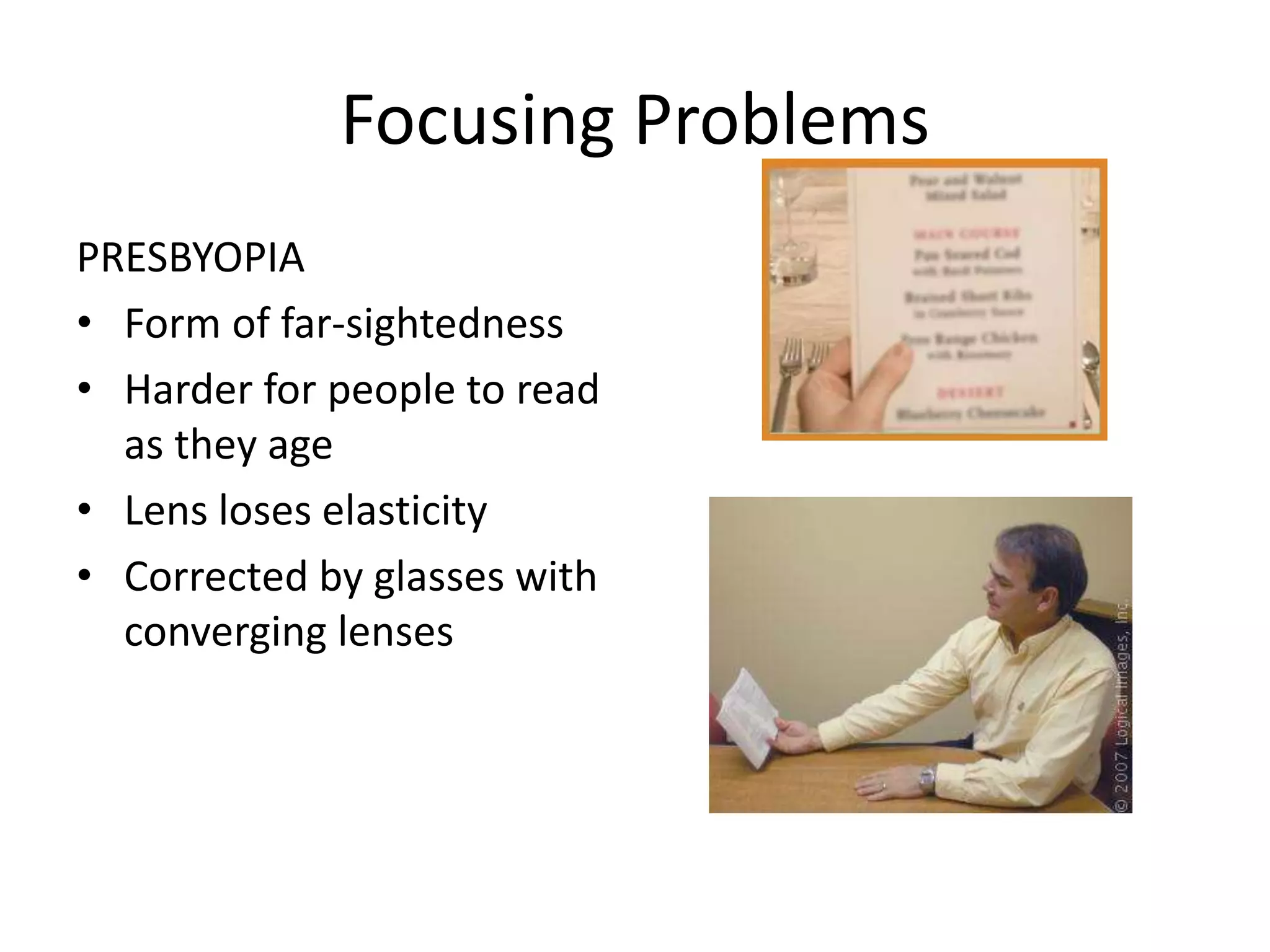 The Human Eye PowerPoint.pptx