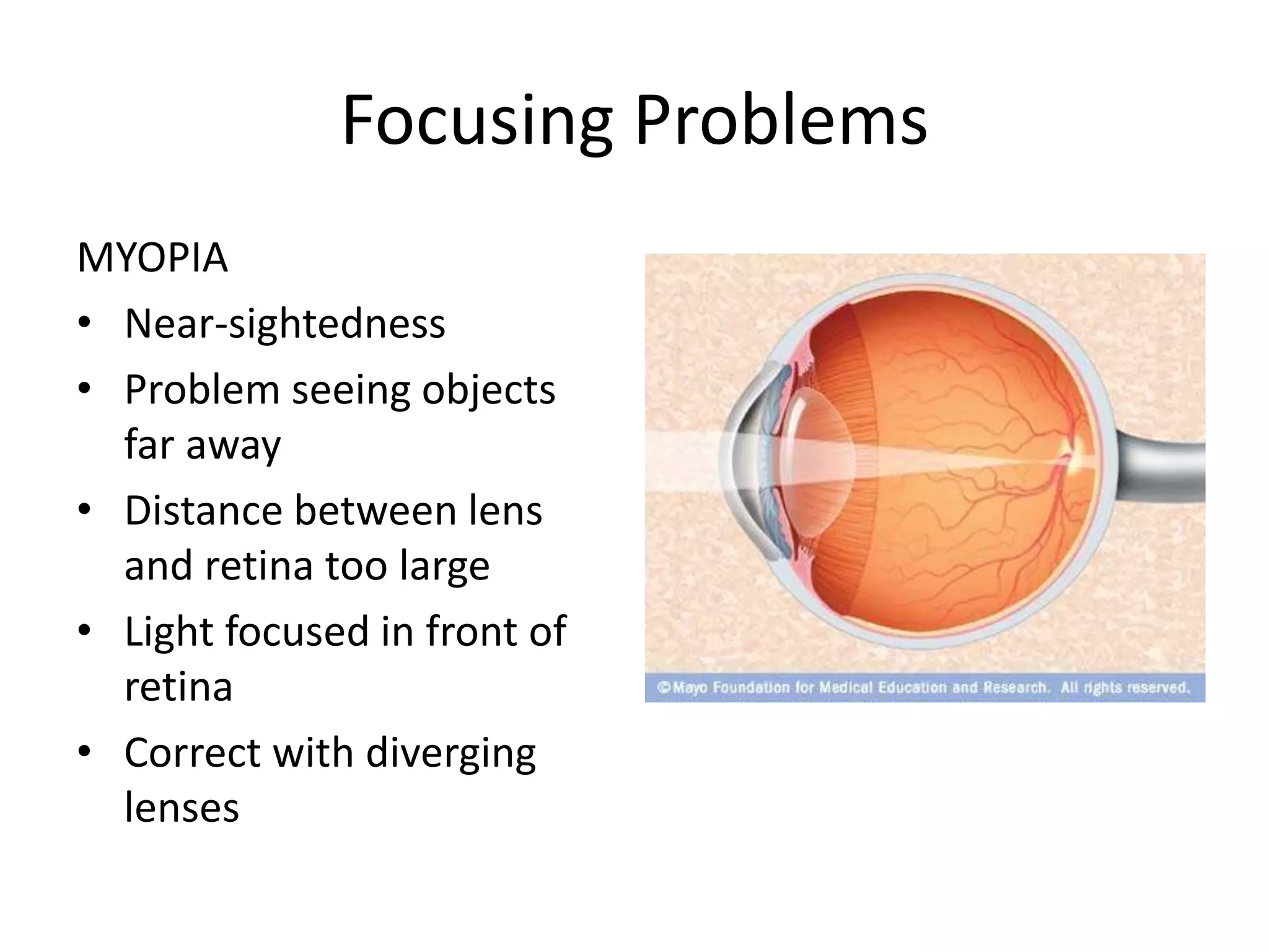 The Human Eye PowerPoint.pptx