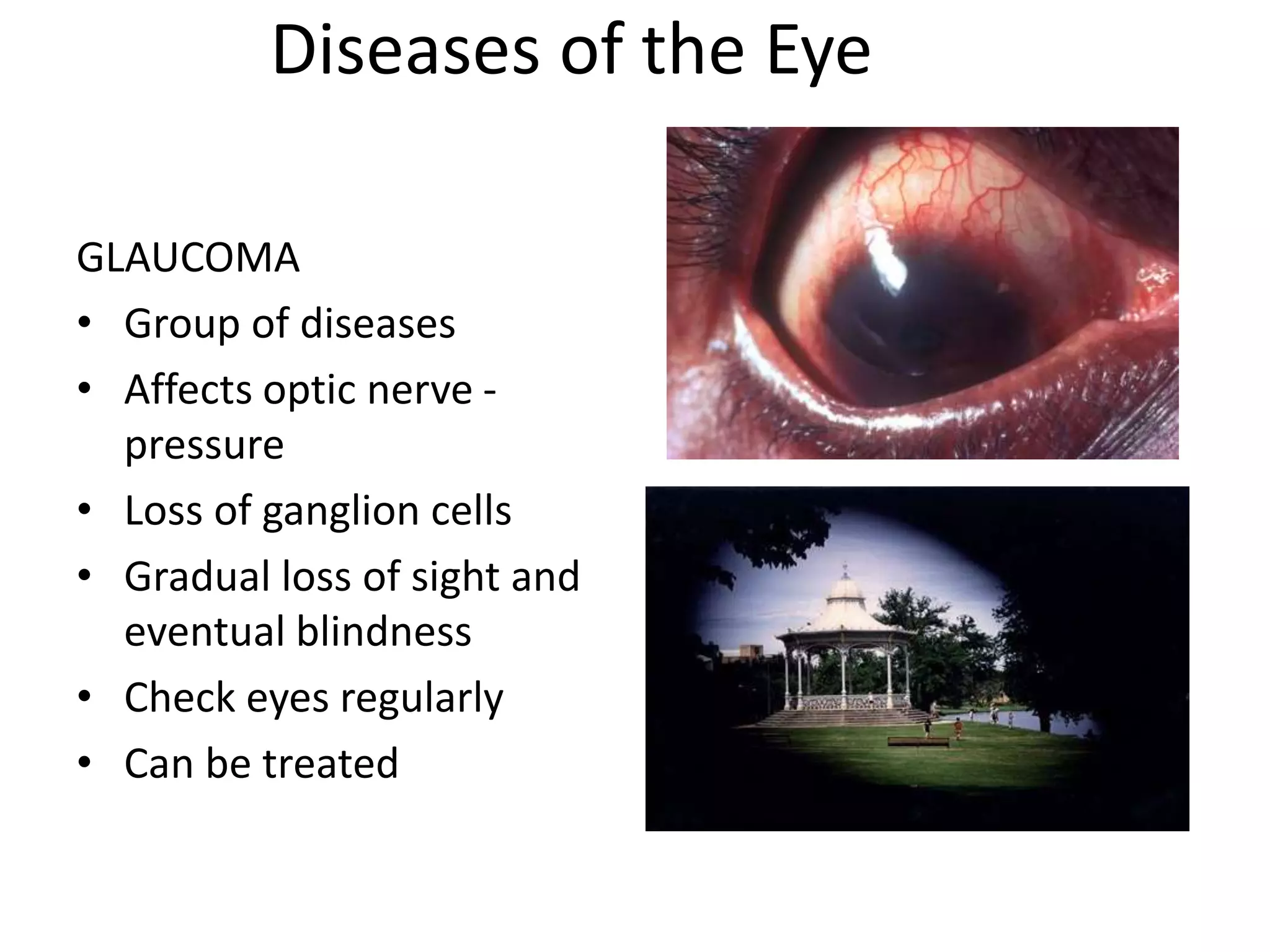 The Human Eye PowerPoint.pptx