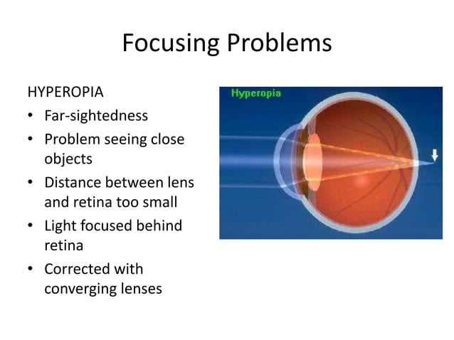 The Human Eye PowerPoint.pptx