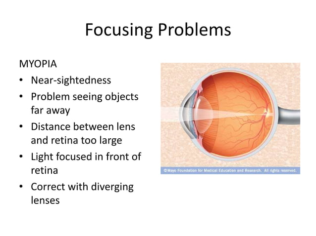 The Human Eye PowerPoint.pptx