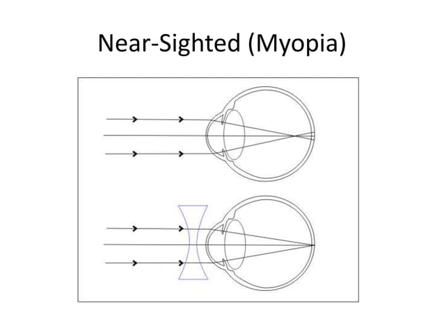 The Human Eye PowerPoint.pptx