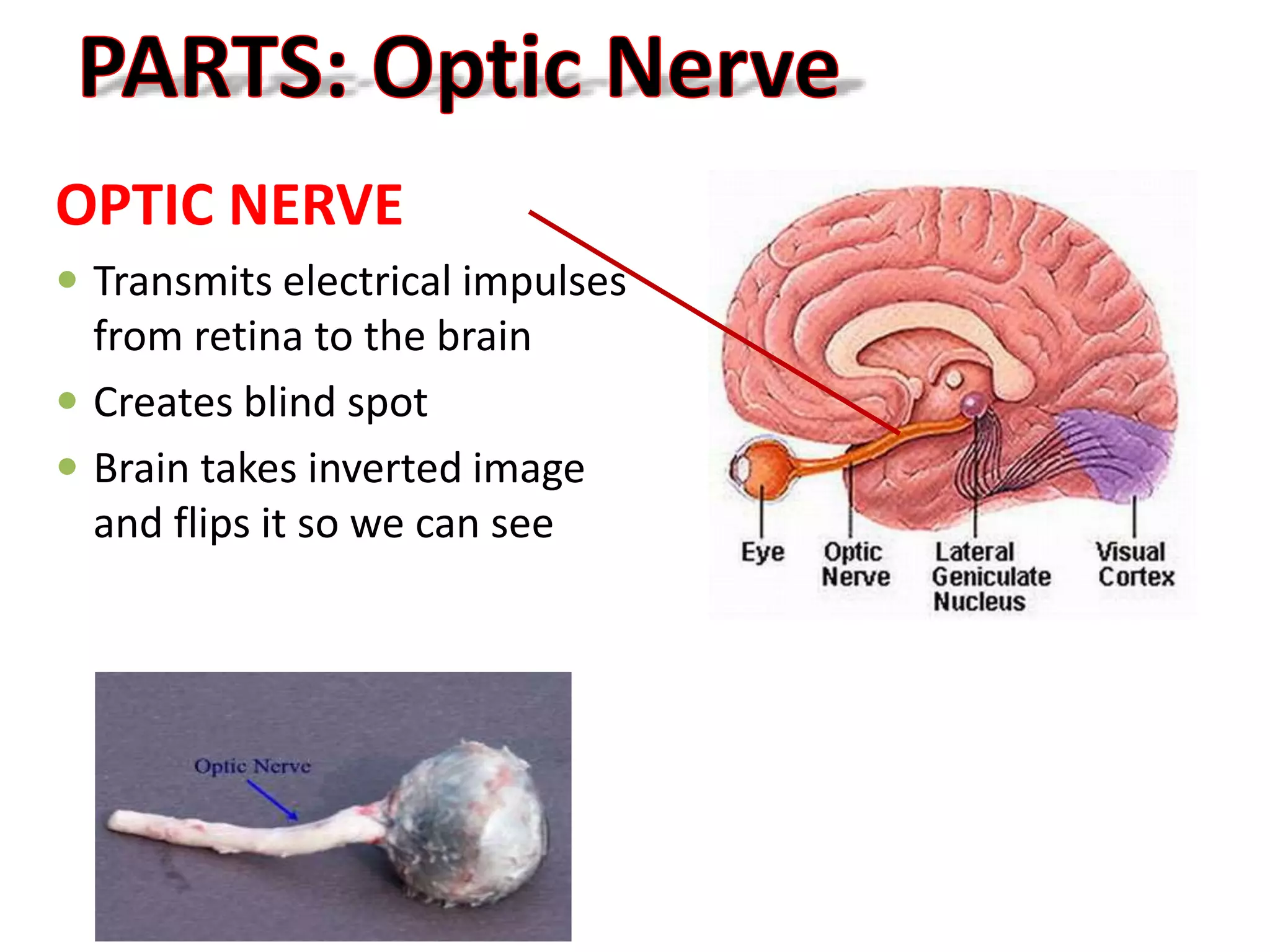 The Human Eye PowerPoint.pptx | Eye and Vision Conditions | Diseases ...