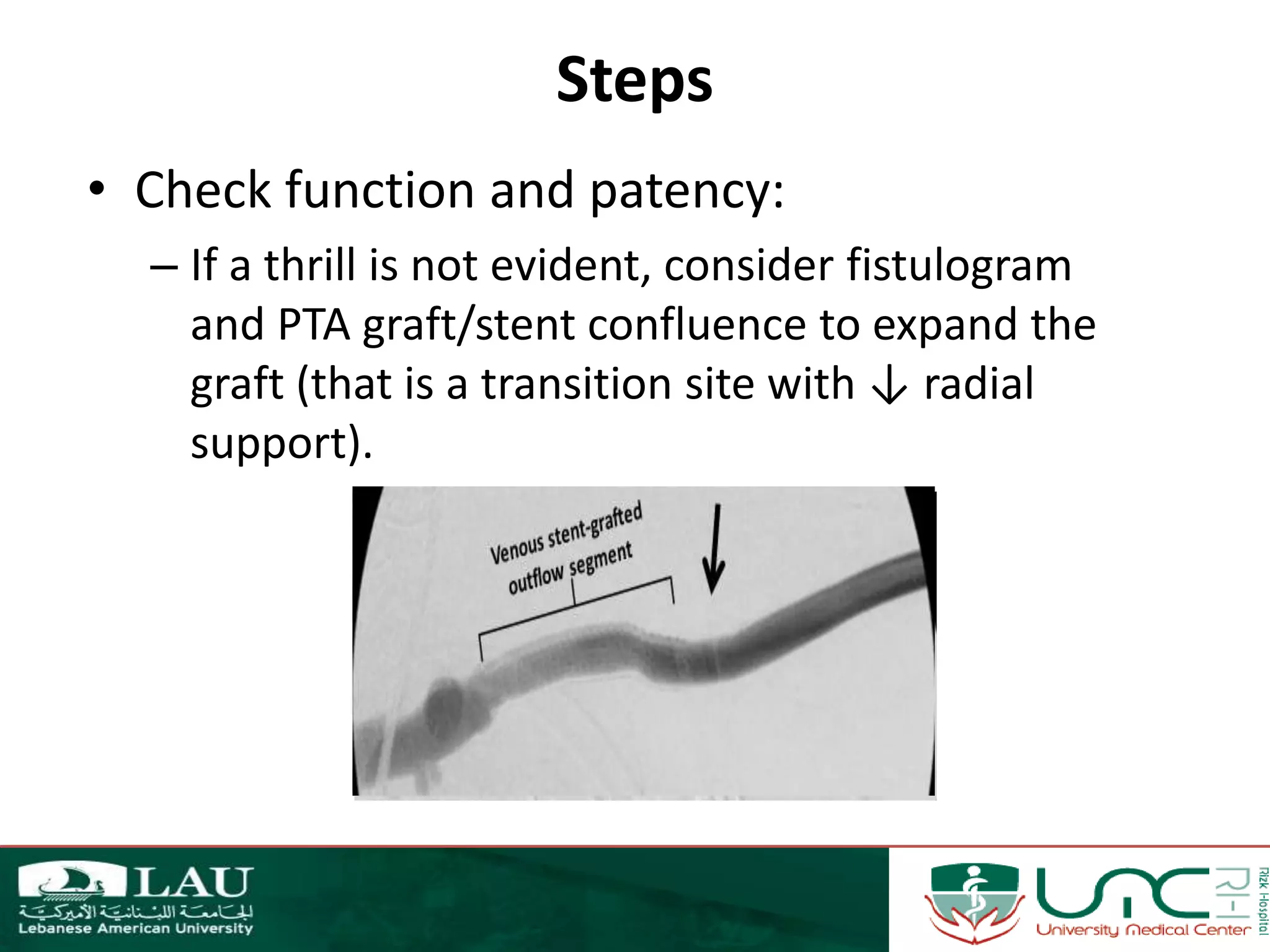 The hybrid vascular e ptfe graft as an alternative for hemodialysis ...
