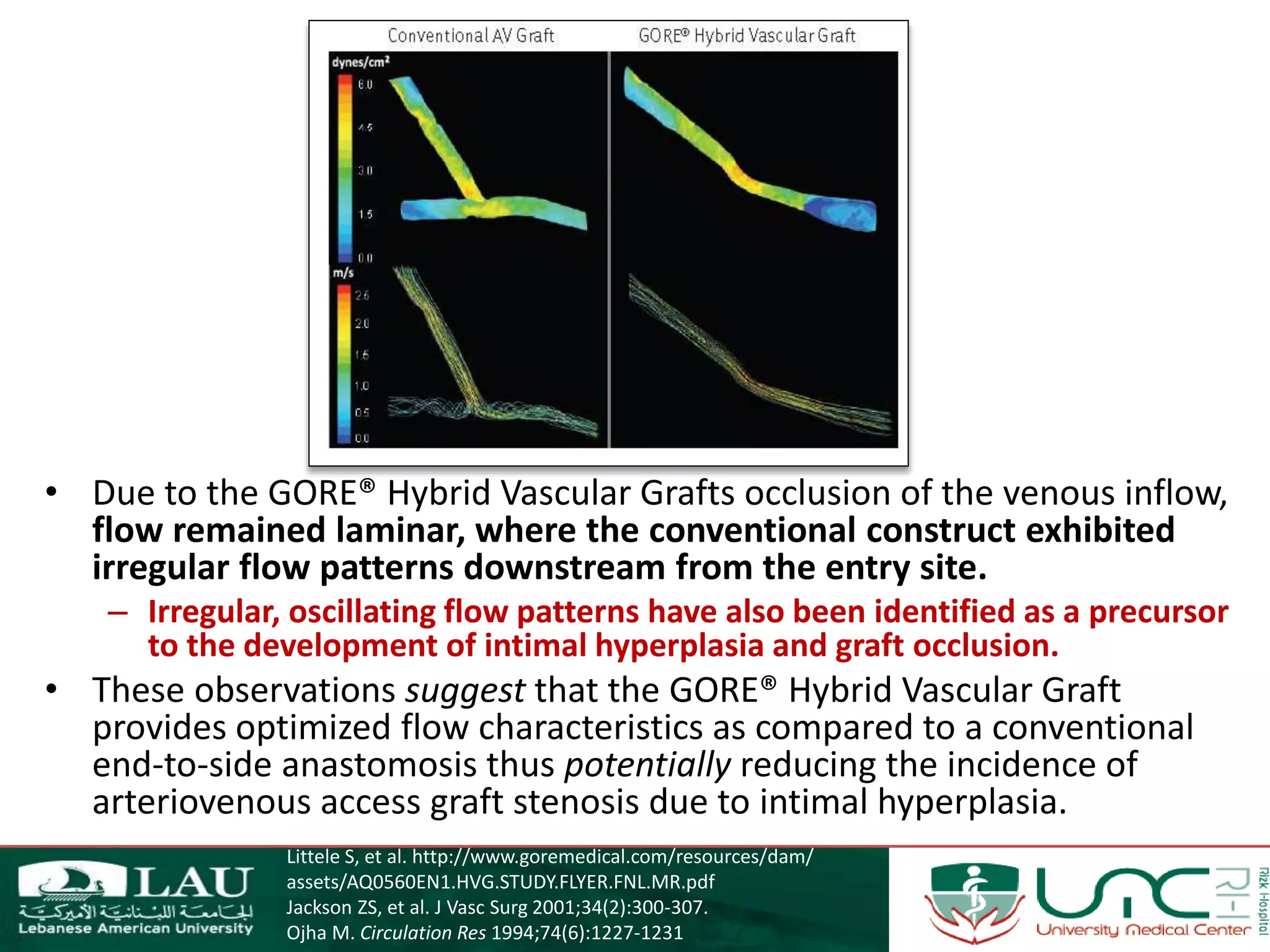 The hybrid vascular e ptfe graft as an alternative for hemodialysis ...
