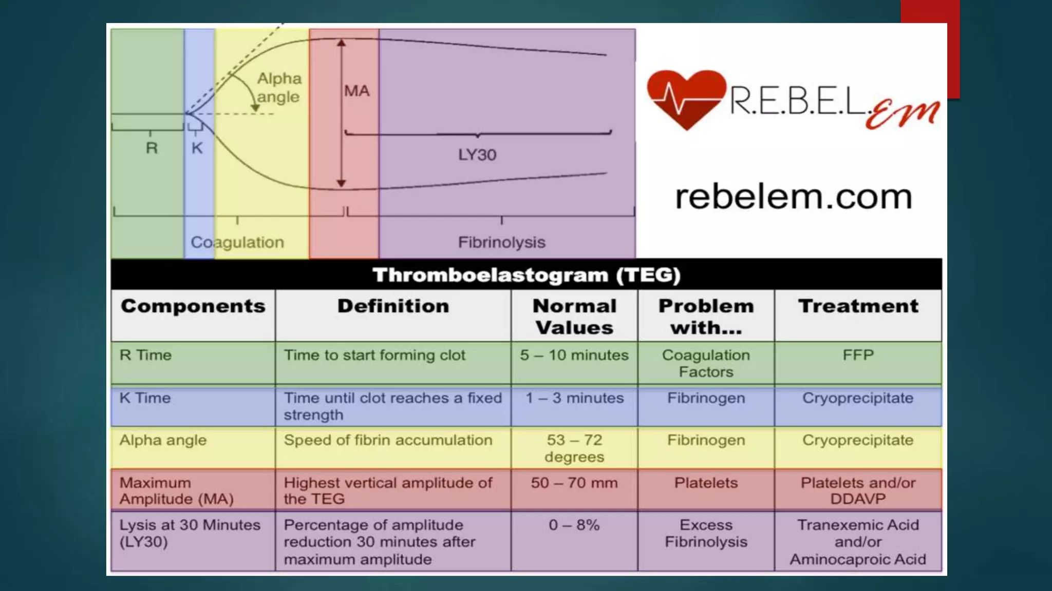The hypercoagulable states in anaesthesia | PPTX