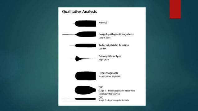 The hypercoagulable states in anaesthesia | PPTX | Blood Disorders ...