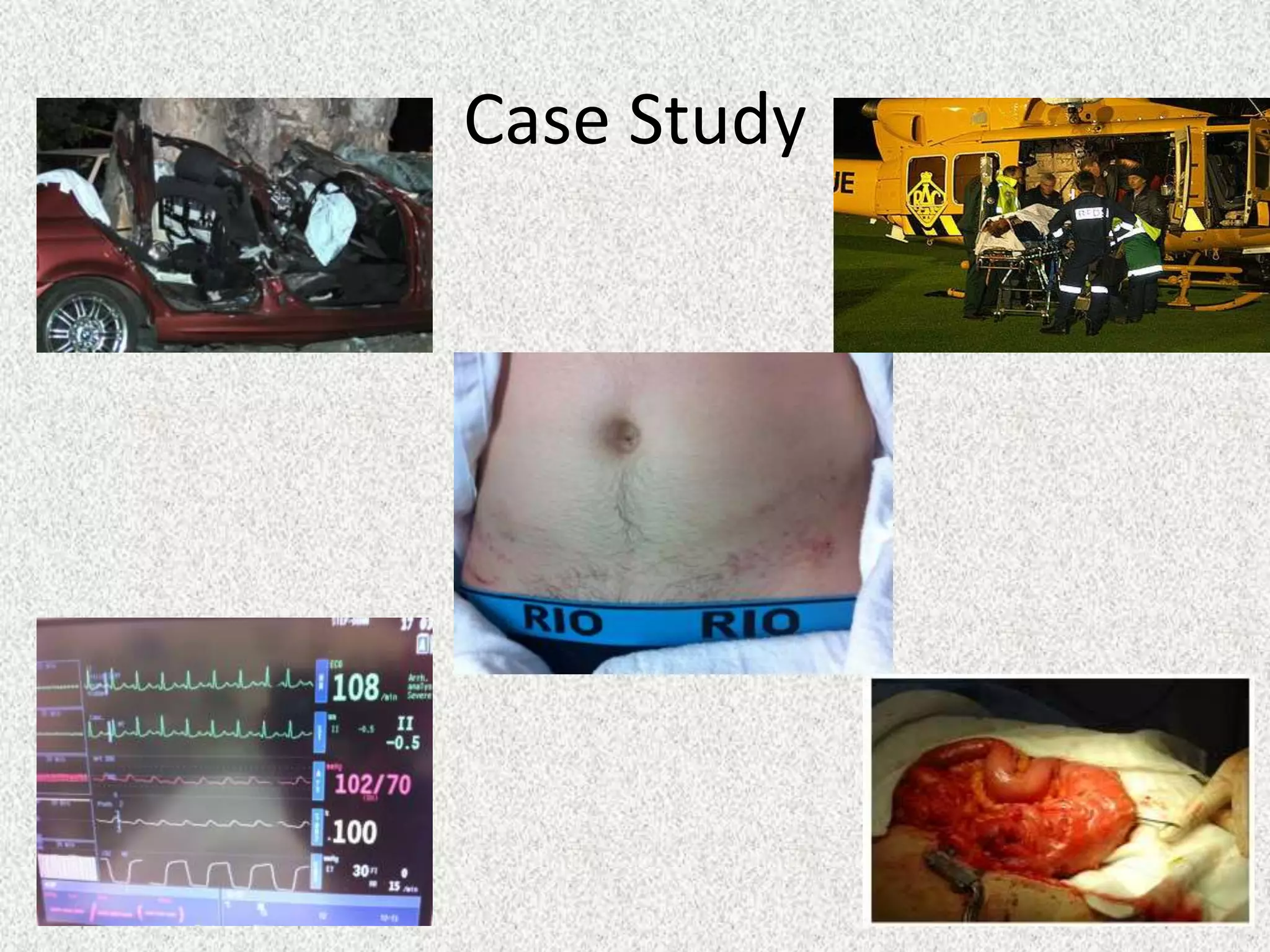 The hypotensive trauma patient | PPTX