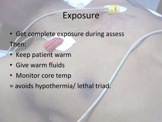 The hypotensive trauma patient | PPTX