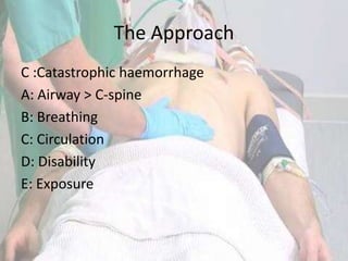 The hypotensive trauma patient | PPTX