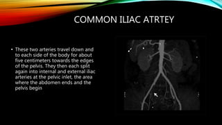 The iliac artery | PPTX