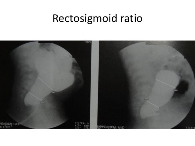 The images of GI tract emergencies in pediatrics