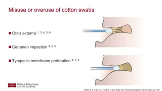 THE IMPACT OF COTTON SWAB USE ON THE EXTERNAL AUDITORY CANAL | PPT