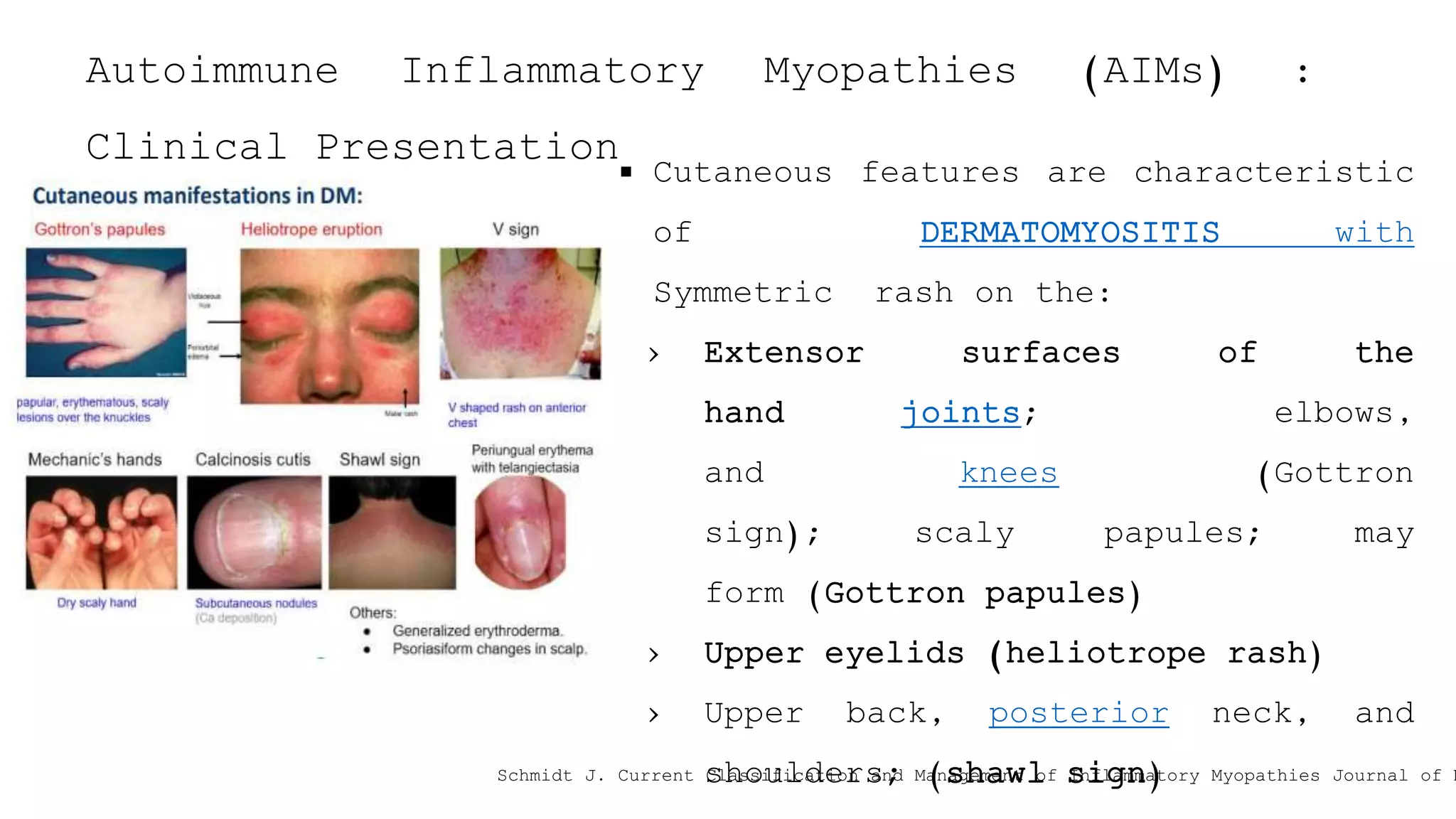 The Importance of Autoantibody Detection PPT revisi.pptx