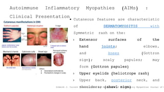 The Importance of Autoantibody Detection PPT revisi.pptx