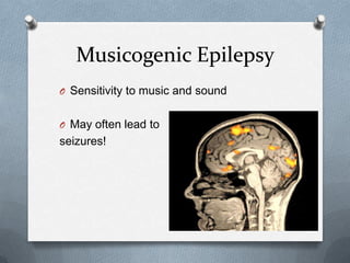 The importance of music | PPTX