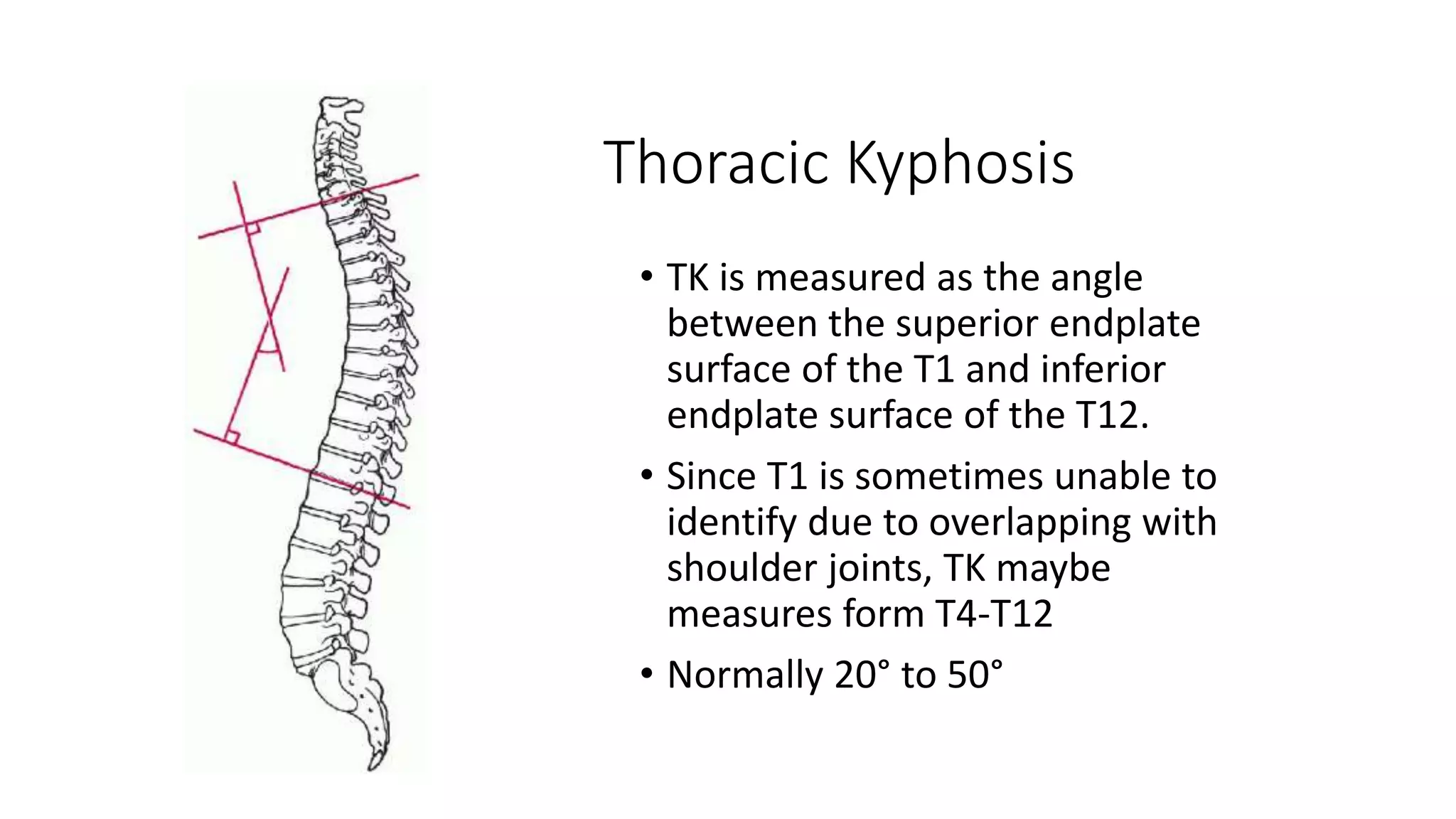 The Importance of Sagittal Balance in Adult Spinal.pptx