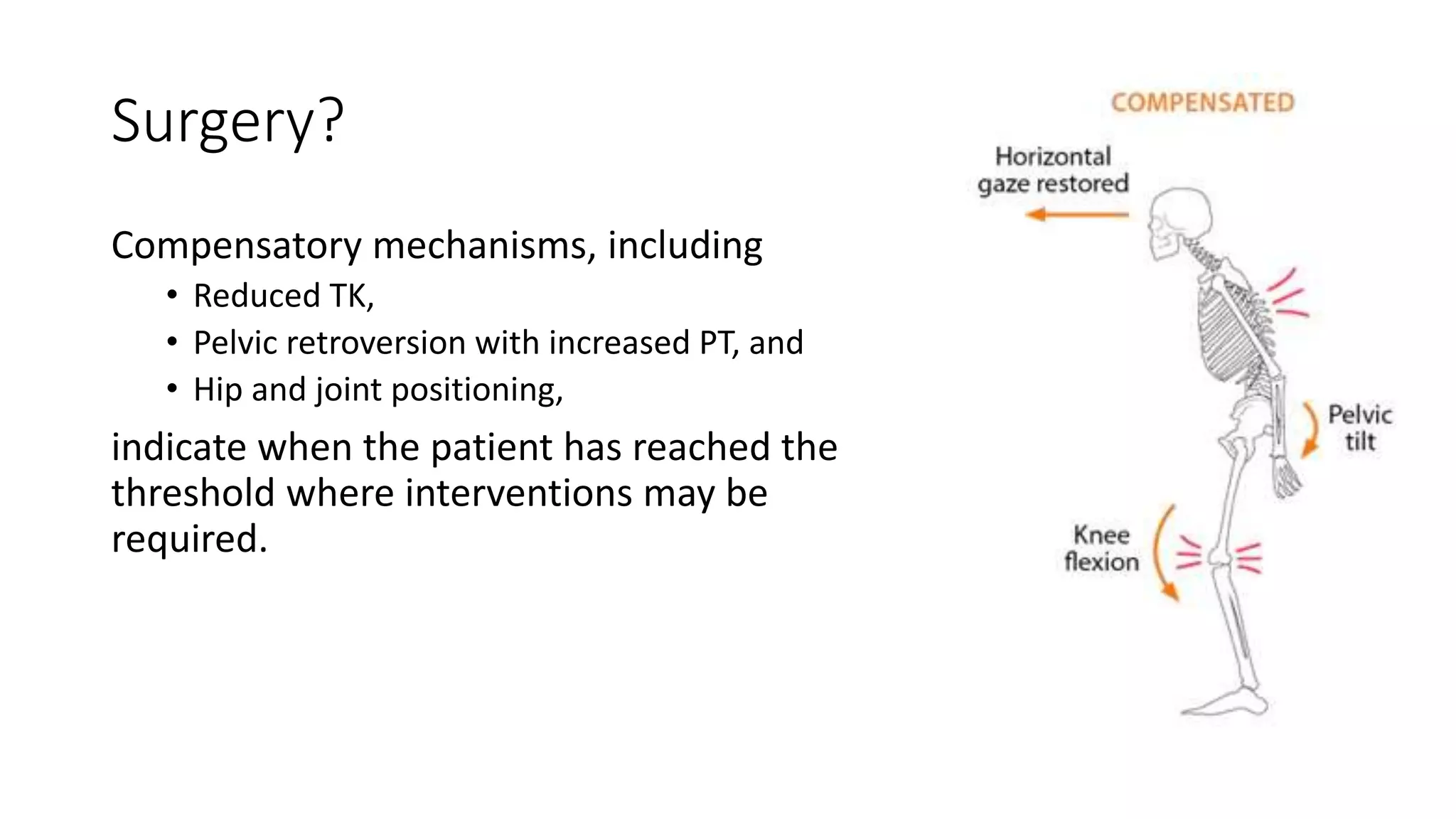 The Importance of Sagittal Balance in Adult Spinal.pptx