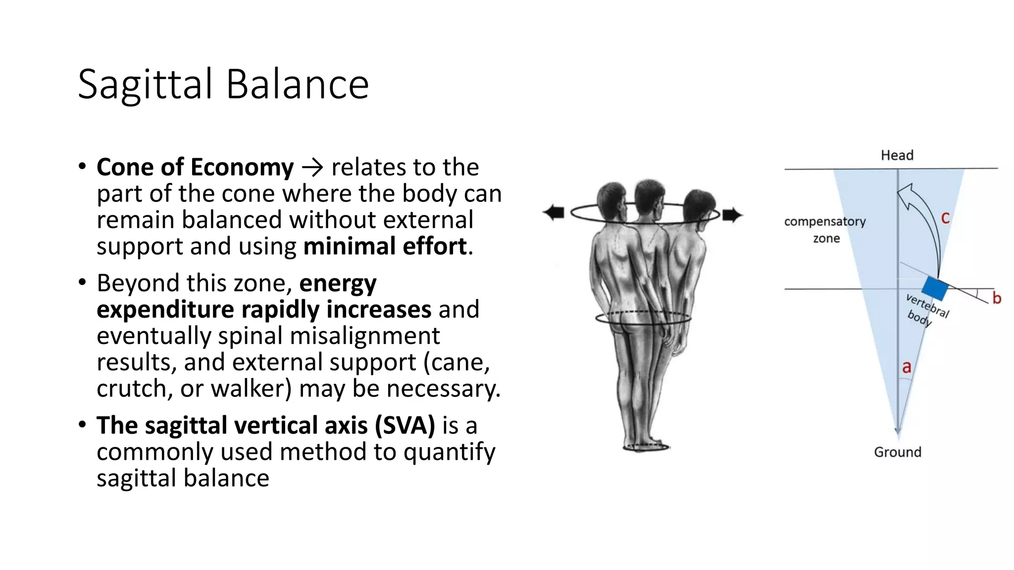 The Importance of Sagittal Balance in Adult Spinal.pptx