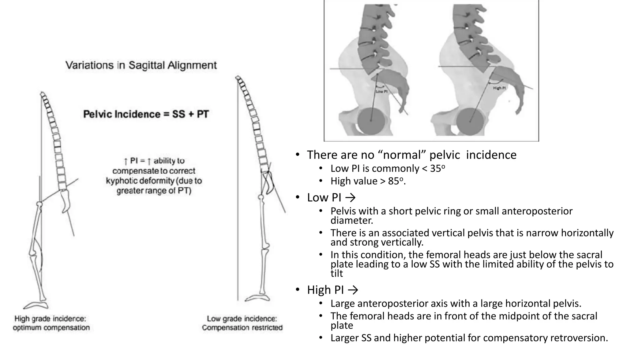 The Importance of Sagittal Balance in Adult Spinal.pptx