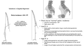The Importance of Sagittal Balance in Adult Spinal.pptx