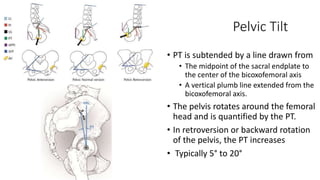 The Importance of Sagittal Balance in Adult Spinal.pptx